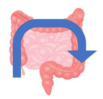 Intussusception – Carolinas Pediatric Emergency Medicine Fellowship