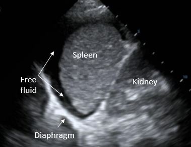 E-FAST – Carolinas Pediatric Emergency Medicine Fellowship