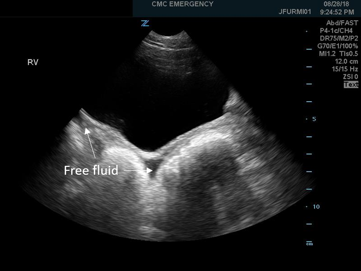 E-FAST – Carolinas Pediatric Emergency Medicine Fellowship