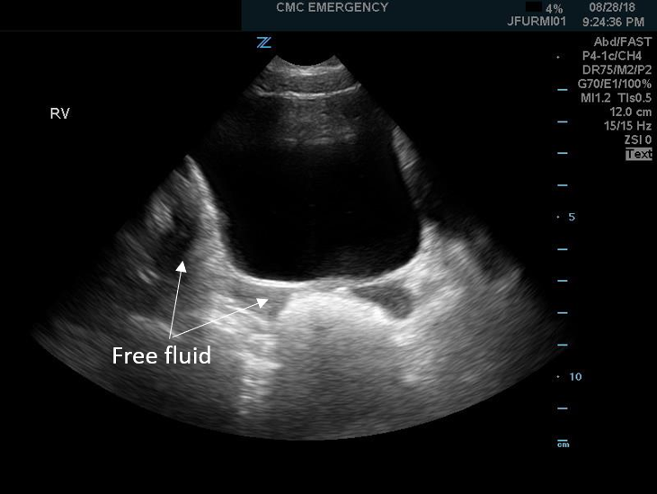 E-FAST – Carolinas Pediatric Emergency Medicine Fellowship